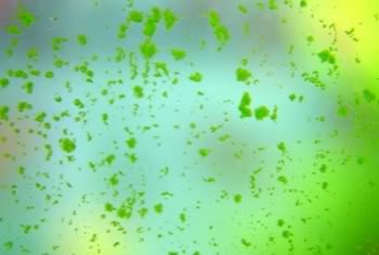 Types of Algae Growth Found in a Tropical Fish Tank - Tropical Fish Site